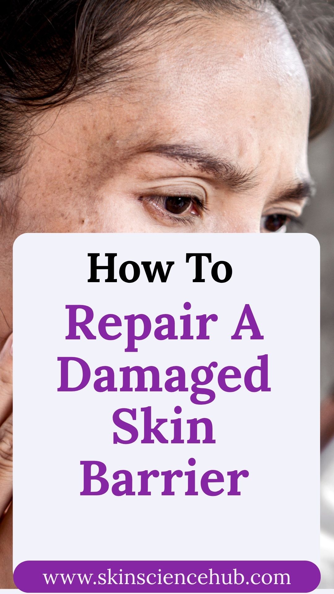 Skin Barrier Damage: How to Fix It Fast