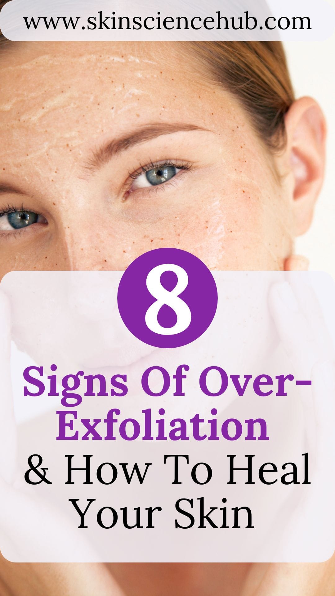 Over Exfoliated Skin: Signs, How to Fix It & Prevention