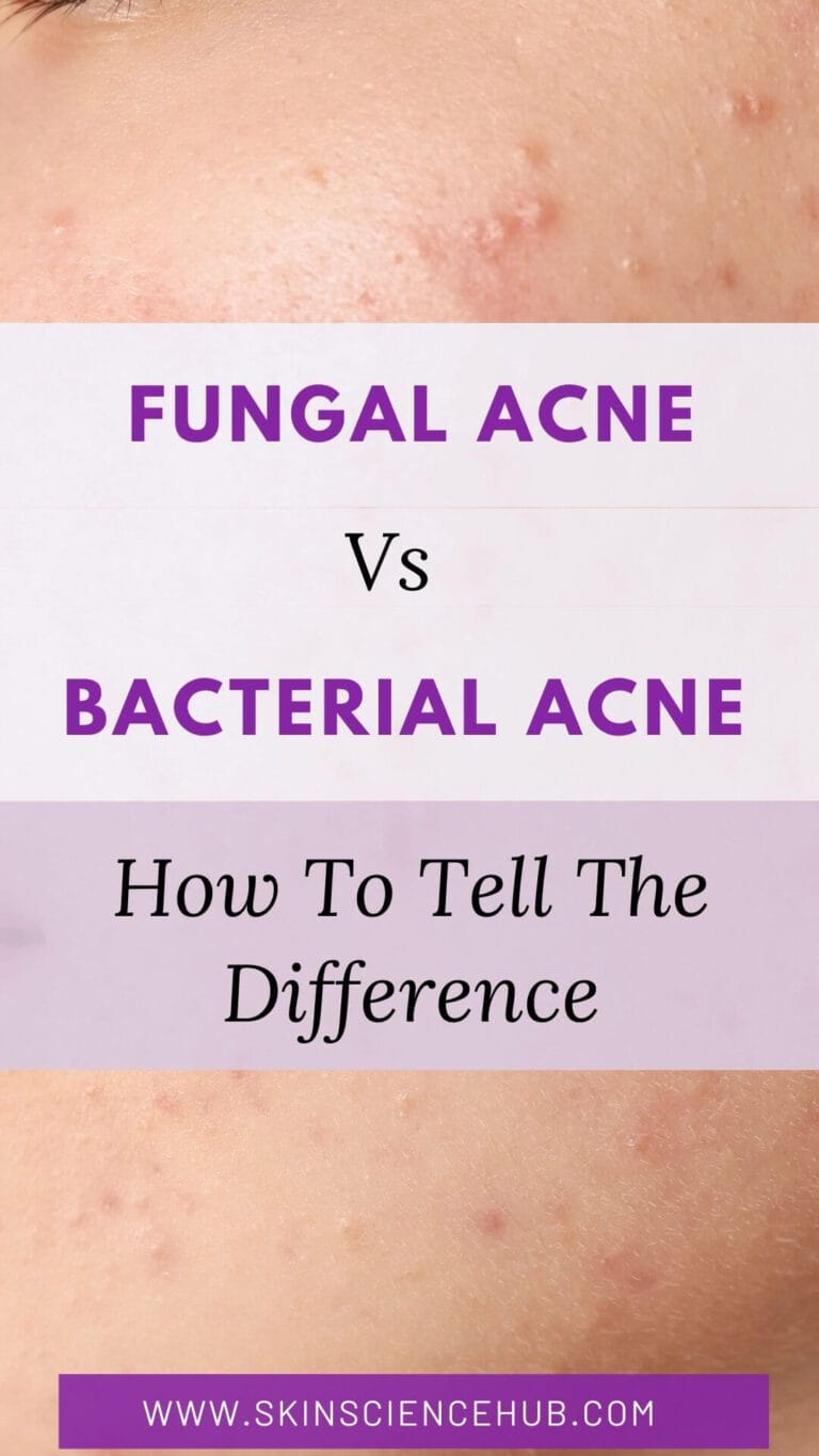 Fungal Acne or Bacterial Acne? How to Tell & Treat It